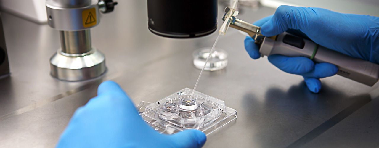 Polscope (Spindle View) – Op.Dr.Suat Hazer